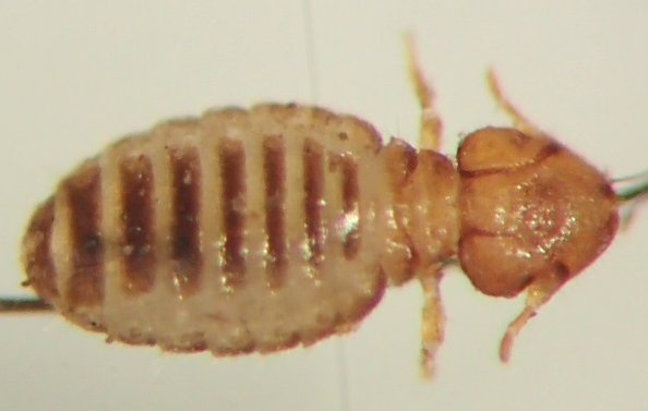 Why are Lice Such a PEST? - ParaBoss